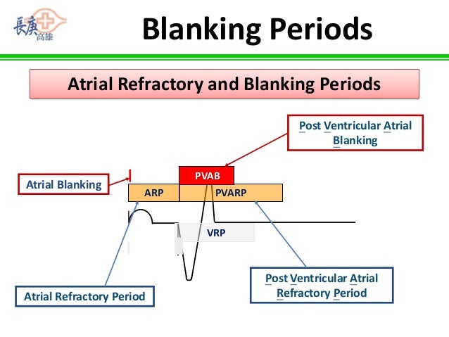 心臟植入性電子儀器(CIED)的基本原理及設定