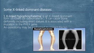 X-linked disease | PPTX