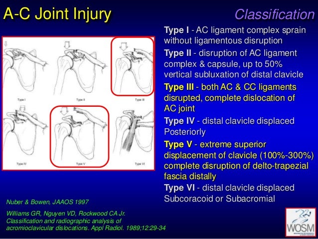 Rockwood Classification Of Acromioclavicular Joint