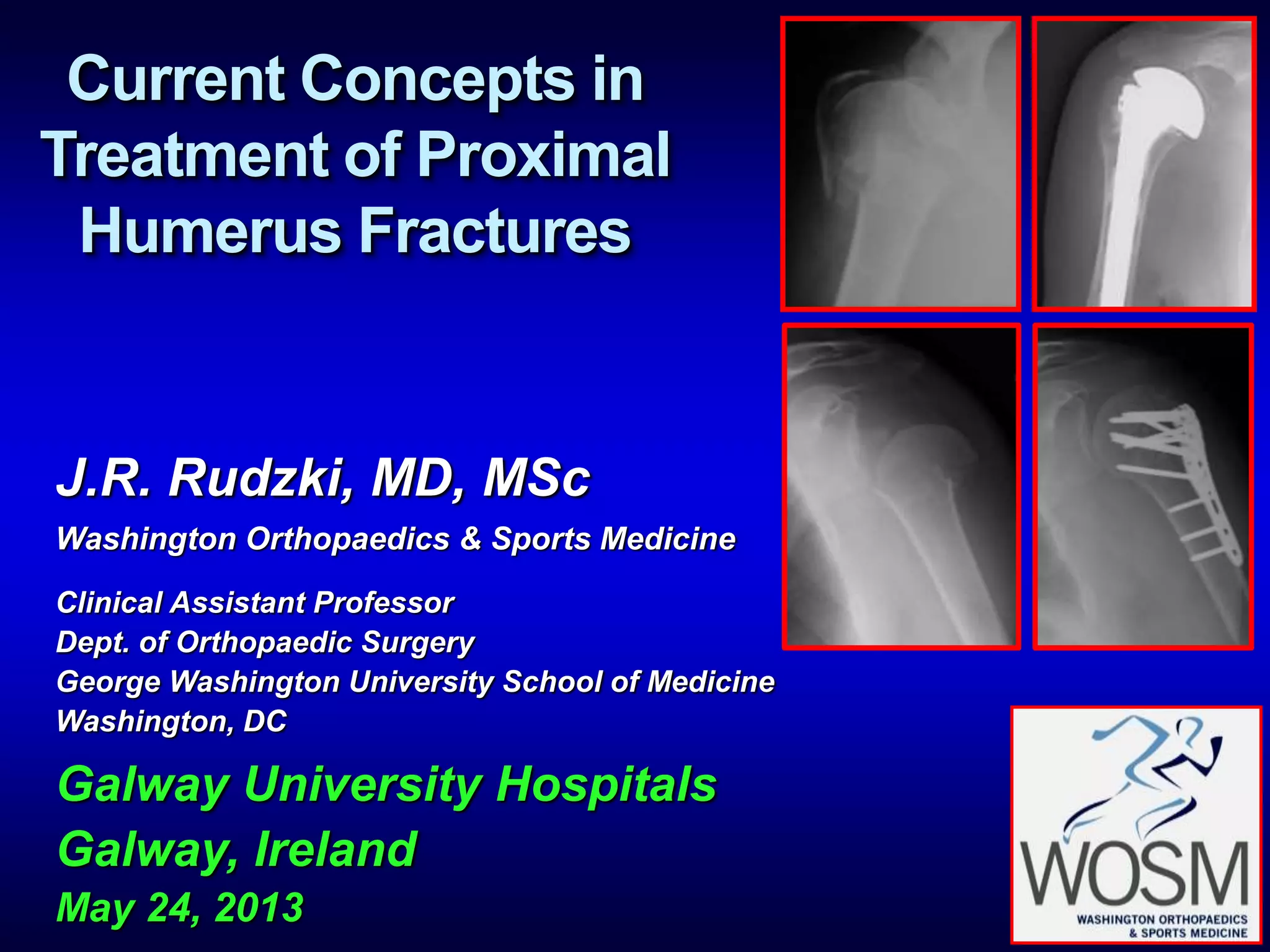 Current Concepts in Treatment of Proximal Humerus Fractures | PPTX