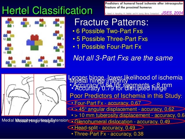 Current Concepts in Treatment of Proximal Humerus Fractures