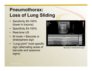 Imaging of Abdominal Trauma | PDF
