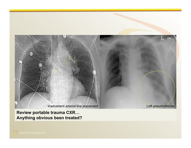 Imaging of Abdominal Trauma | PDF | First Aid | Injuries