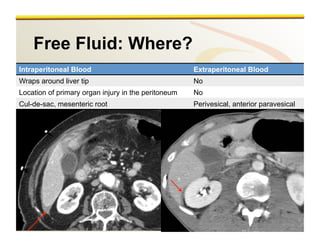 Imaging of Abdominal Trauma | PDF