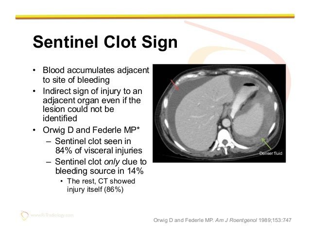 Imaging of Abdominal Trauma