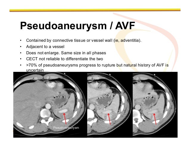 Imaging of Abdominal Trauma