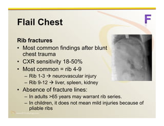 Flail Chest X Ray