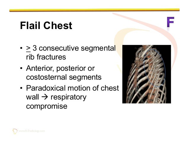 Imaging of Thoracic Trauma