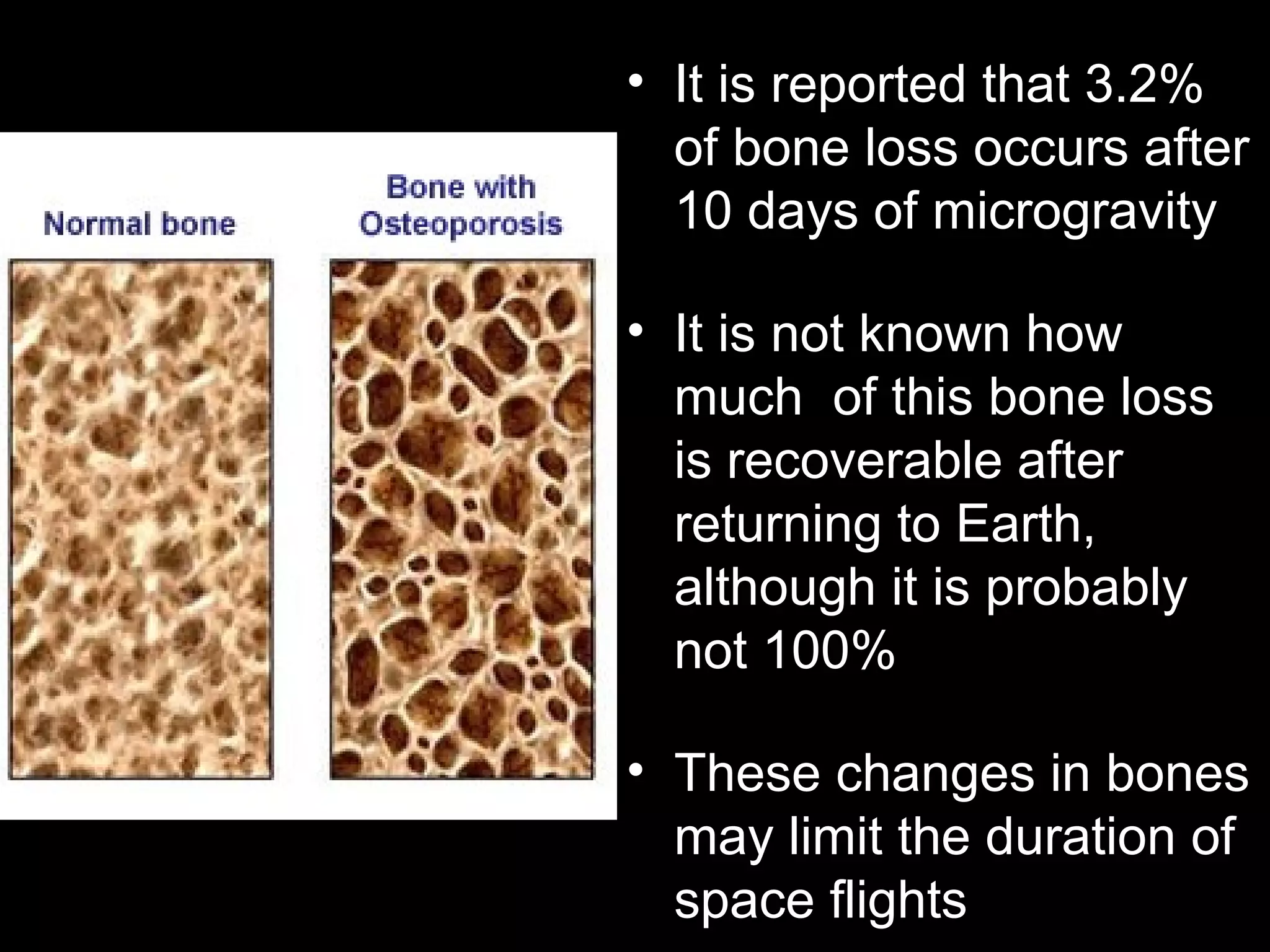 Human Physiology and Anatomy in Space 2013 | PPT