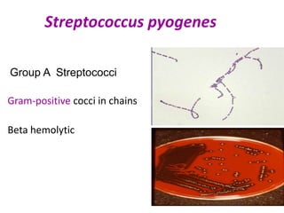 Streptococcus Pyogenes Gram Stain