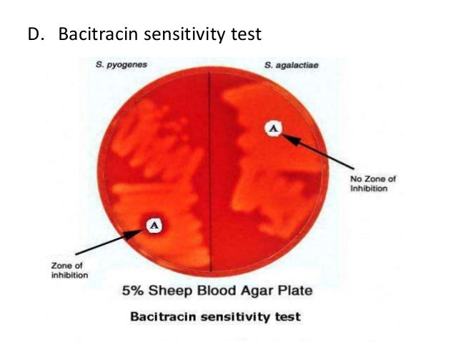 Sreptococci - Prac. Microbiology
