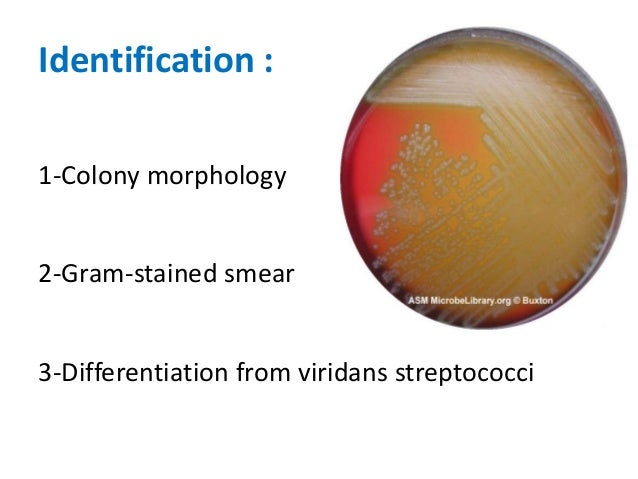 Sreptococci - Prac. Microbiology