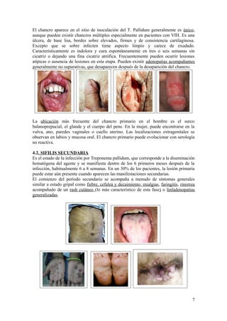 (2014-02-06) Sifilis (doc) | DOC
