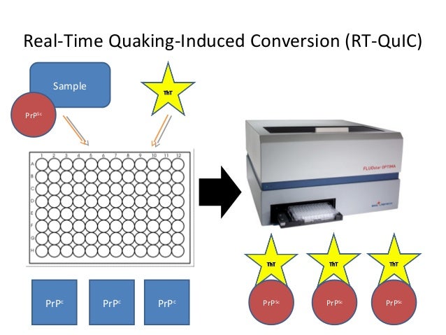 Creutzfeld-Jakob Disease: Diagnosis and Management of Prion Diseases