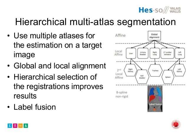 Anatomical Correlations For A Hierarchical Multi Atlas Segmentation O