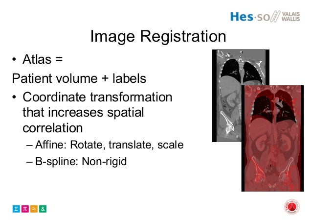 Anatomical Correlations For A Hierarchical Multi Atlas Segmentation O