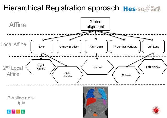 Anatomical Correlations For A Hierarchical Multi Atlas Segmentation O