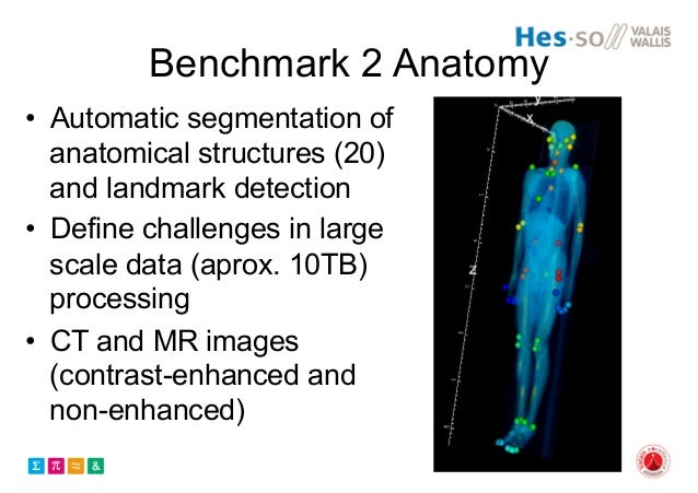 Anatomical Correlations For A Hierarchical Multi Atlas Segmentation O