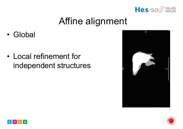 Anatomical Correlations For A Hierarchical Multi Atlas Segmentation O