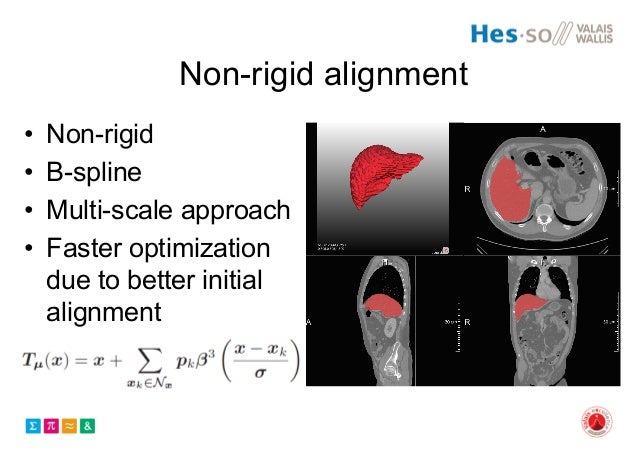 Anatomical Correlations For A Hierarchical Multi Atlas Segmentation O