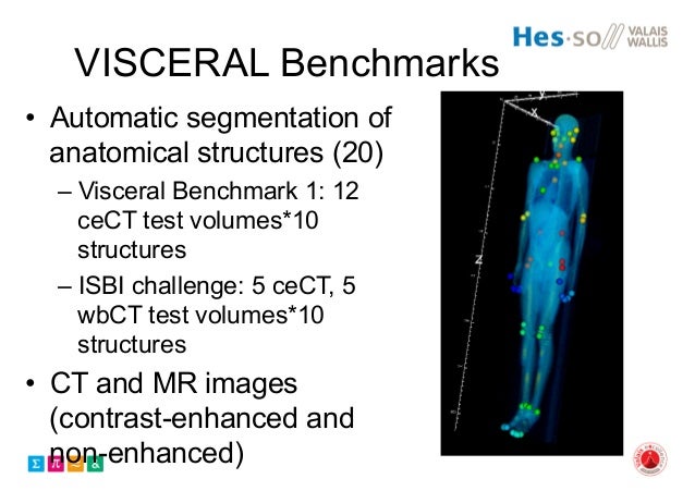 Anatomical Correlations For A Hierarchical Multi Atlas Segmentation O