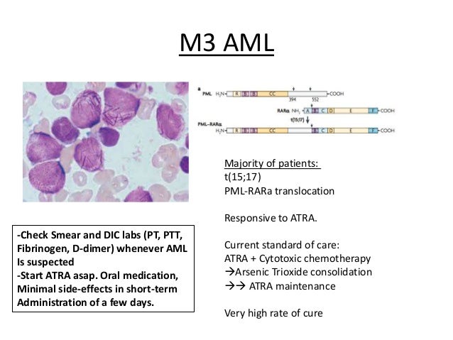 myeloid malignancy overview