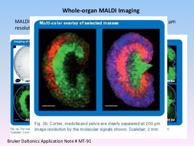 Presentation on the basic Maldi-Imaging workflow with some informatio…