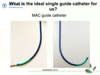 Guo J - AIMRADIAL 2014 - Single guiding catheter in STEMI | PPTX