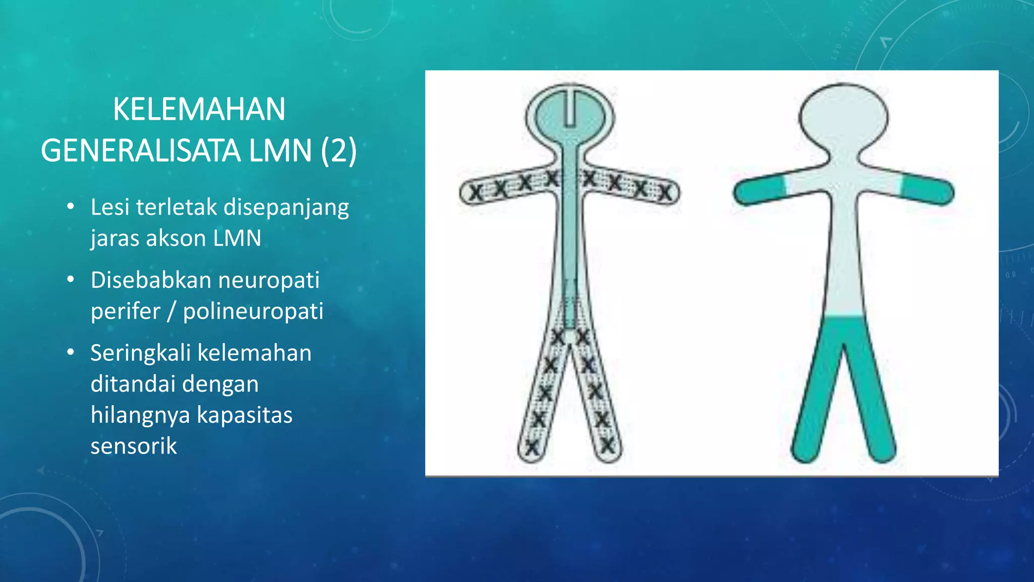 Mengenal Lokasi Gangguan Neurologis | PPTX