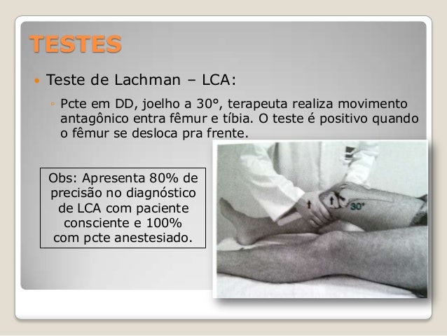 2014827 111116 lesao+ligamentar+joelho