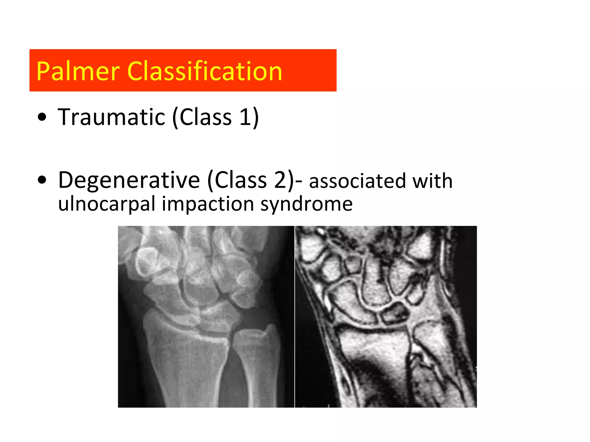 TFCC Repair in 2014: from hammoc to iceberg | PPT