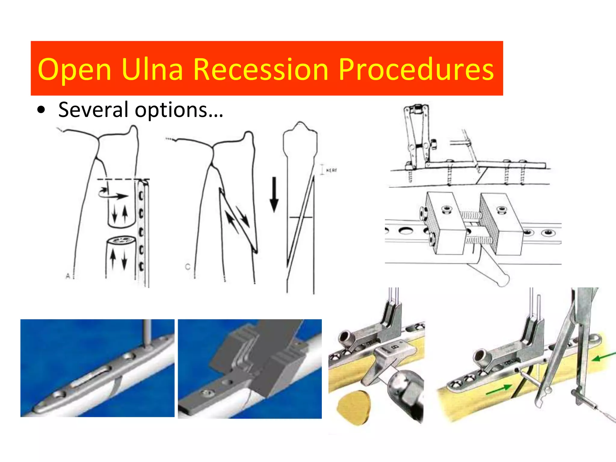 TFCC Repair in 2014: from hammoc to iceberg | PPT