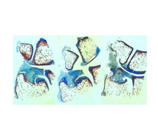 TFCC Repair in 2014: from hammoc to iceberg | PPT
