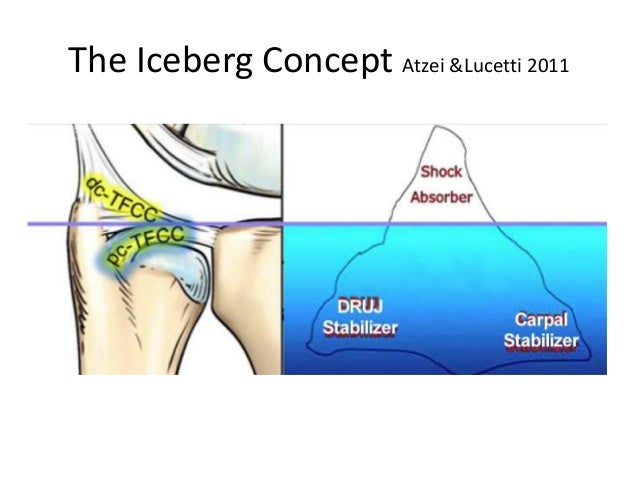 Images of TFCC - JapaneseClass.jp