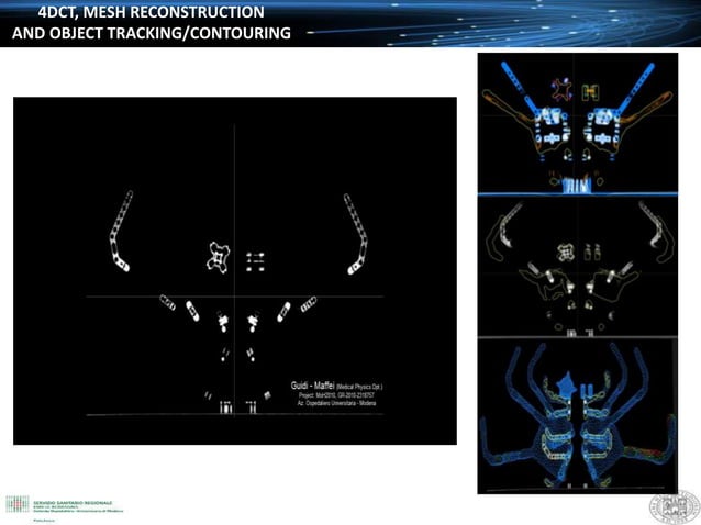 Real-time model for adaptive radiation therapy a biomechanical approach ...
