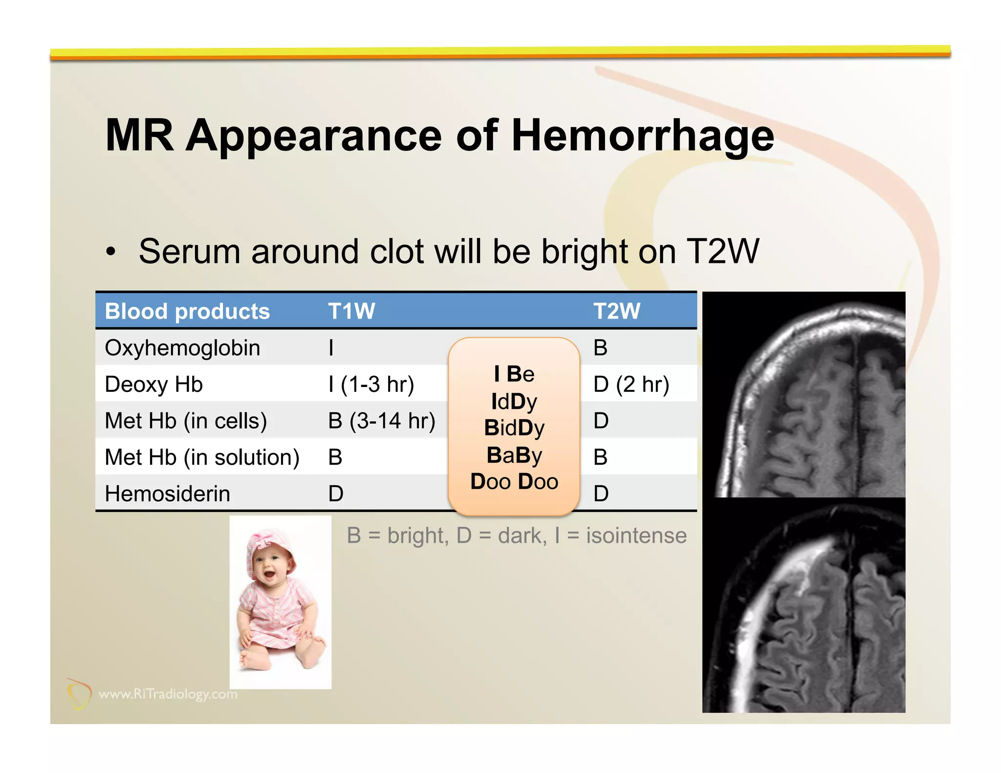 Imaging of Non-traumatic Intracranial Hemorrhage | PDF