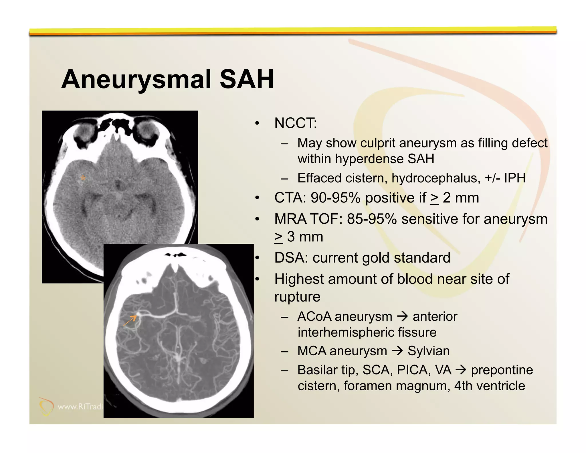 Imaging of Non-traumatic Intracranial Hemorrhage | PDF
