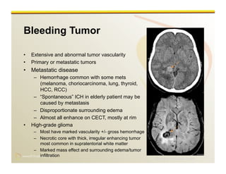 Hemorrhagic Brain Tumors