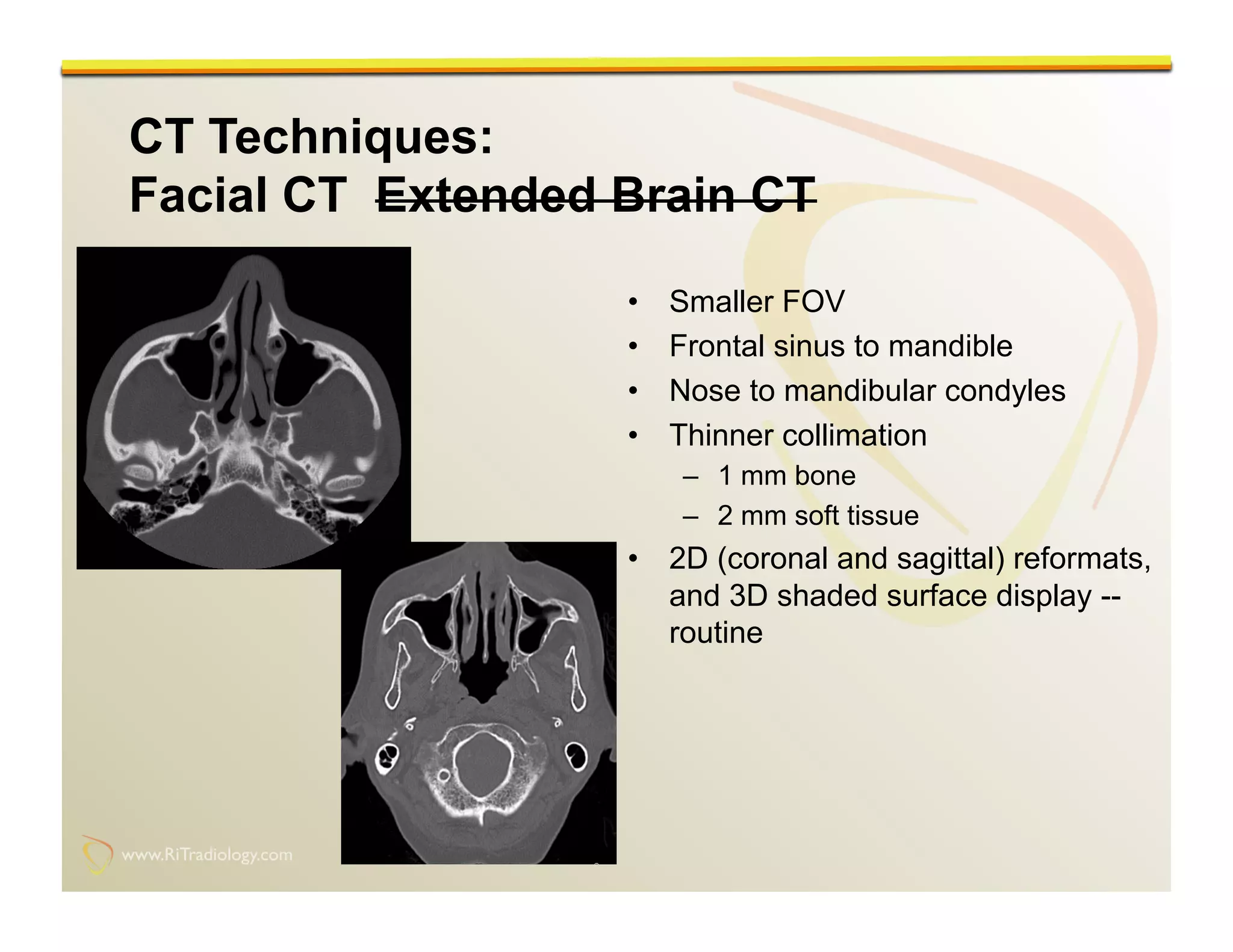 Imaging of Facial Trauma | PDF