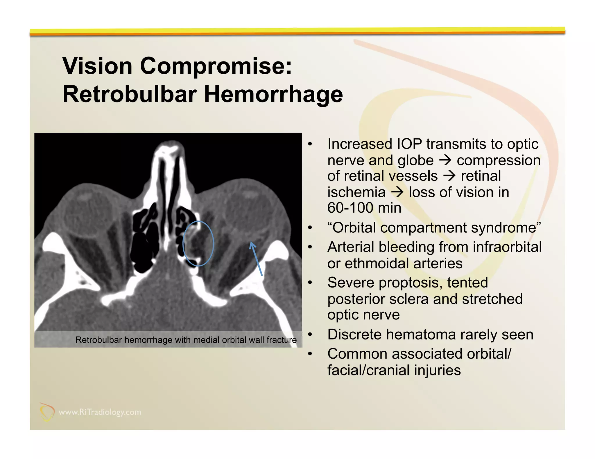 Imaging of Facial Trauma | PDF