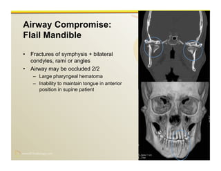 Imaging of Facial Trauma | PDF