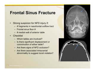 Imaging of Facial Trauma | PDF