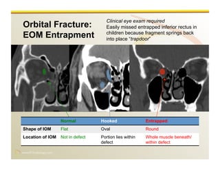 Imaging of Facial Trauma | PDF
