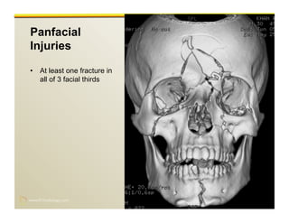 Imaging of Facial Trauma | PDF