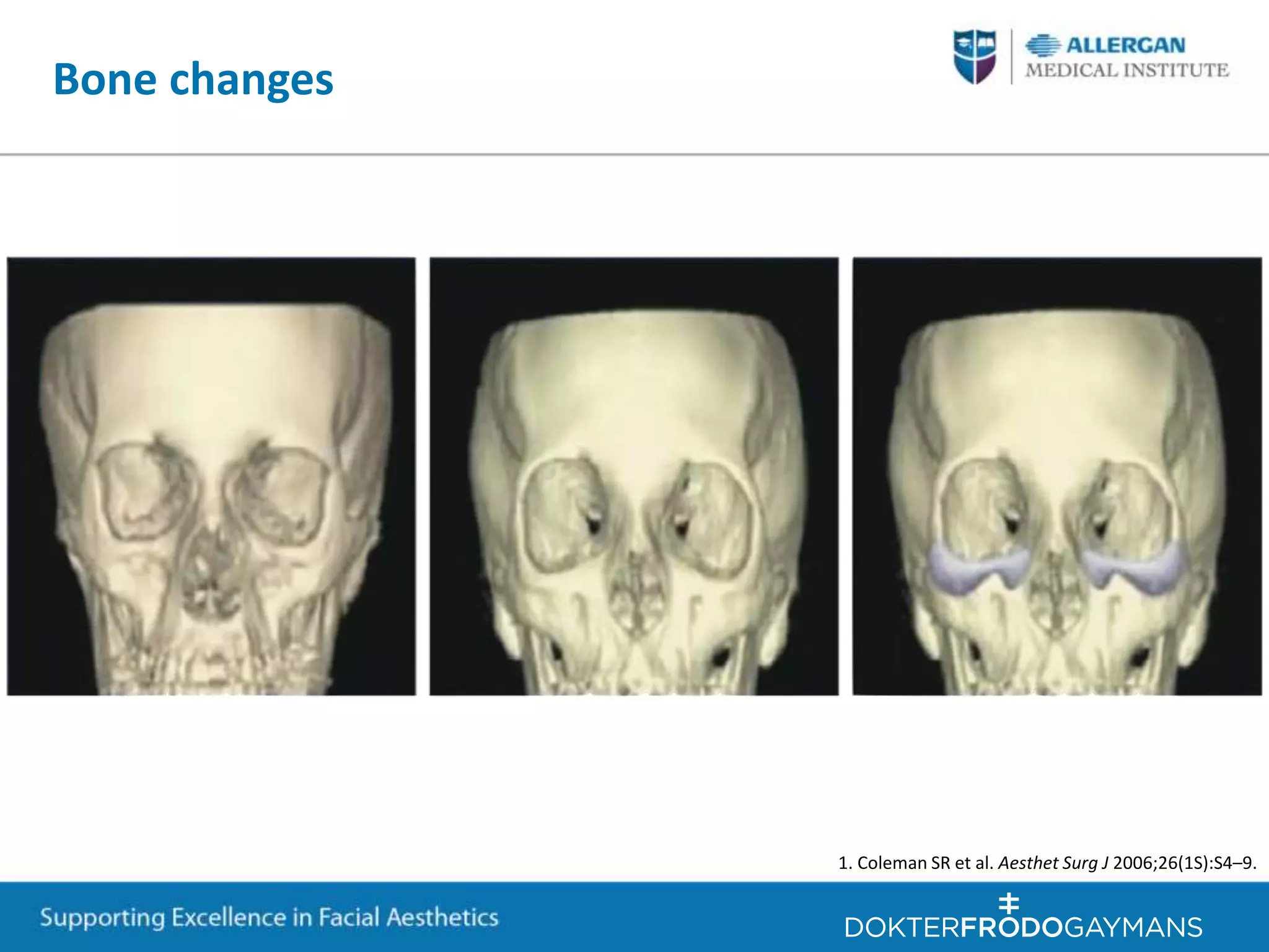 Training for periorbital and upper face treatment with botox and ...