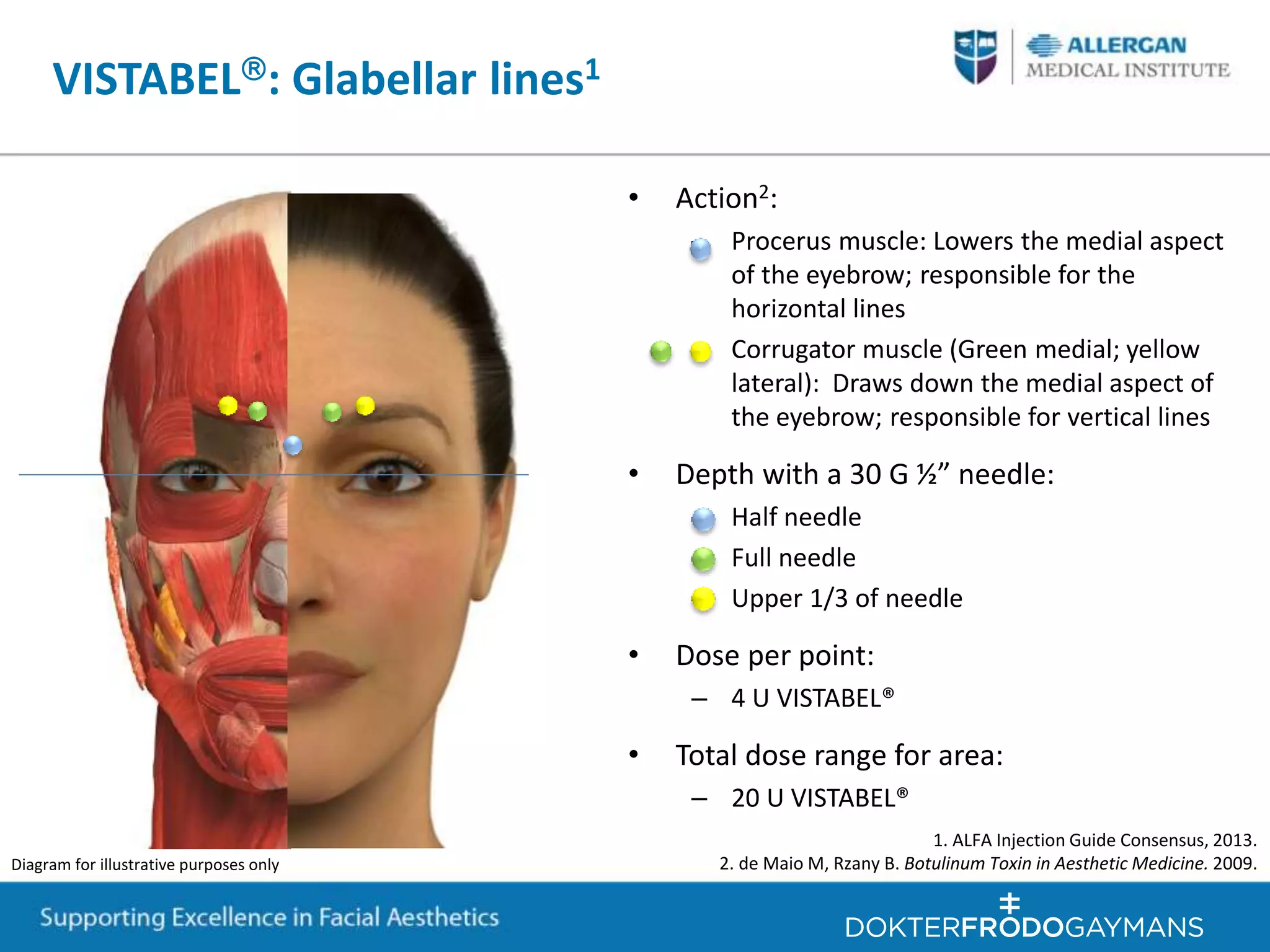 Training for periorbital and upper face treatment with botox and ...