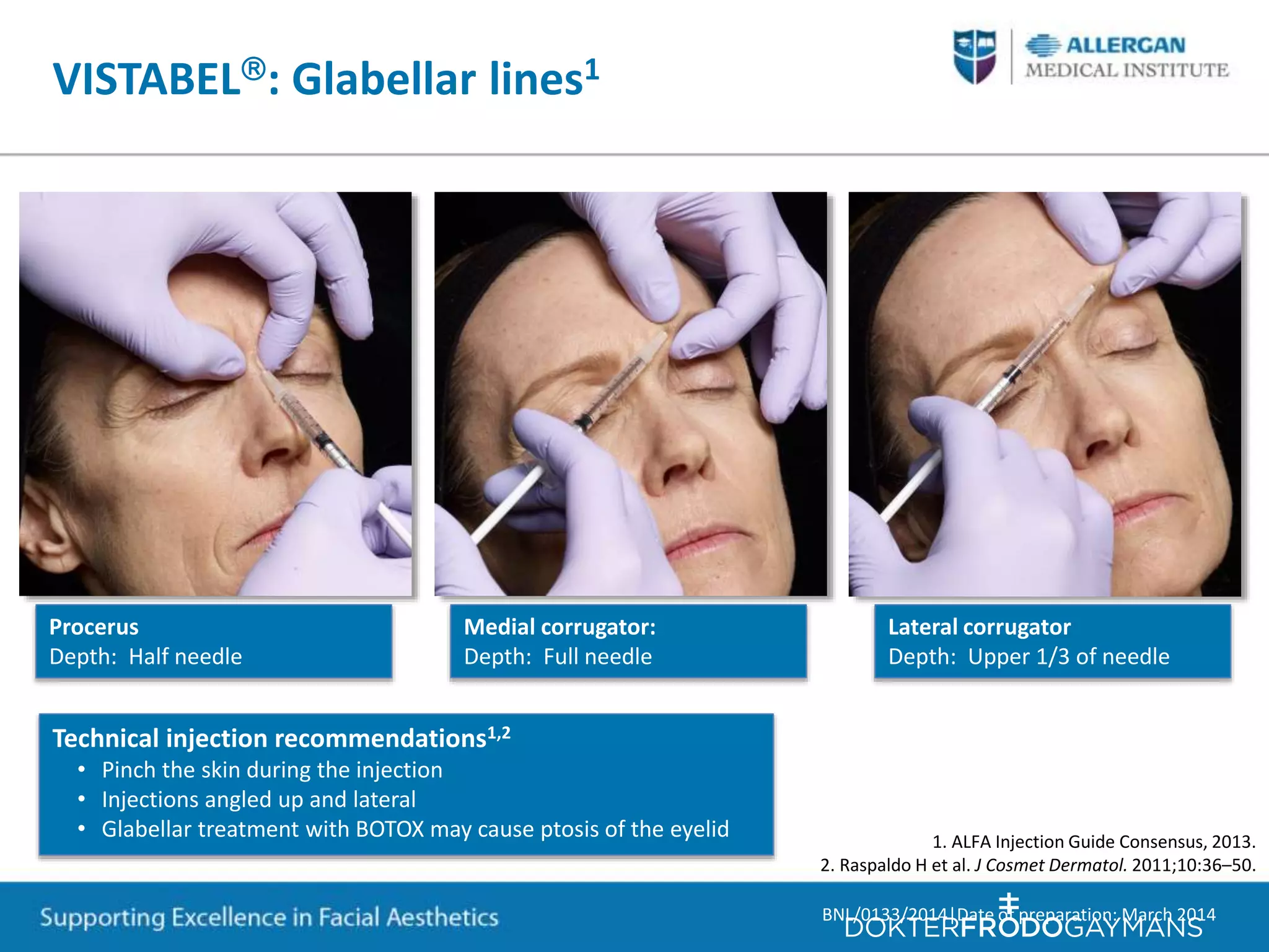 Training for periorbital and upper face treatment with botox and ...