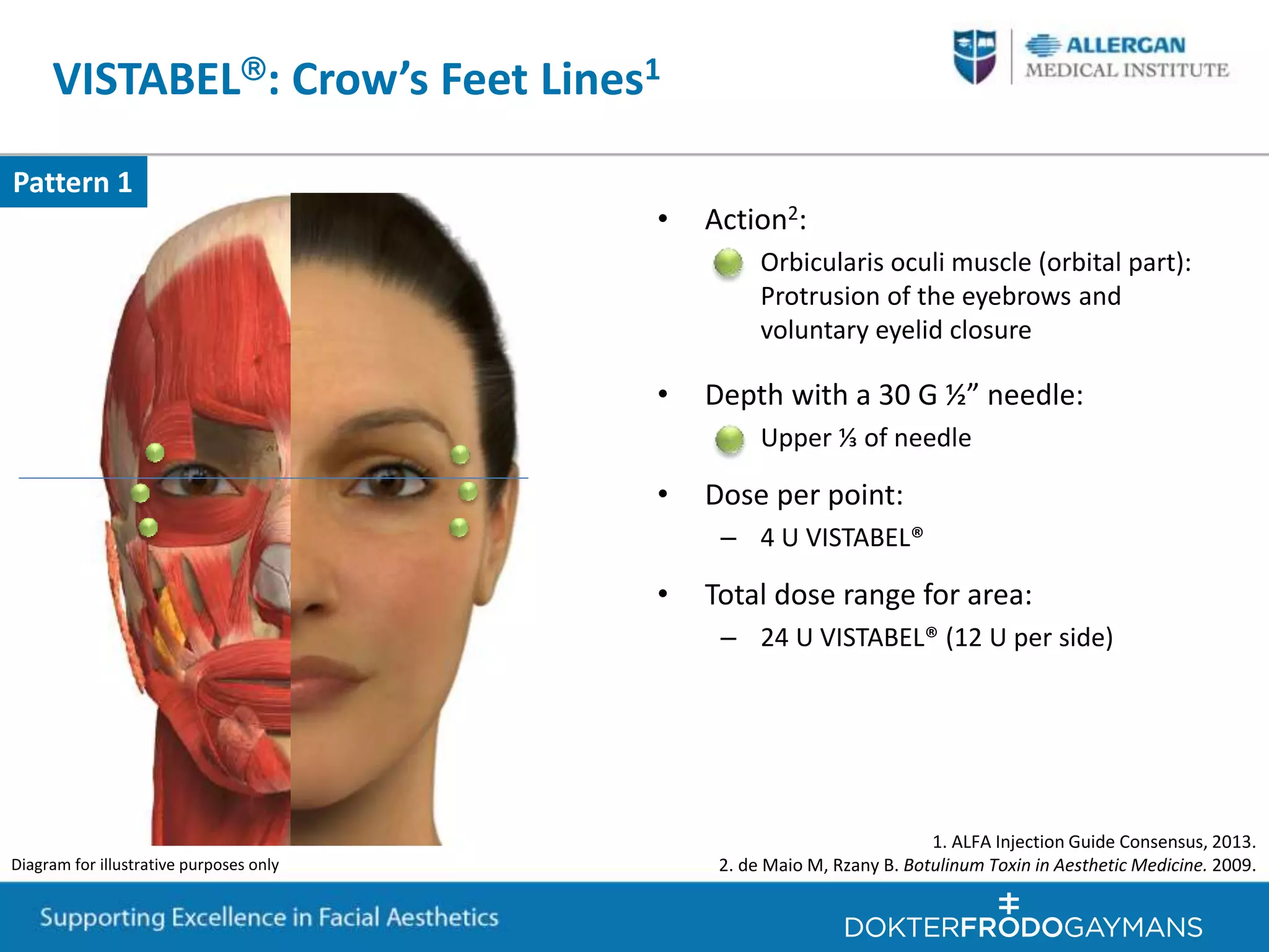Training for periorbital and upper face treatment with botox and ...