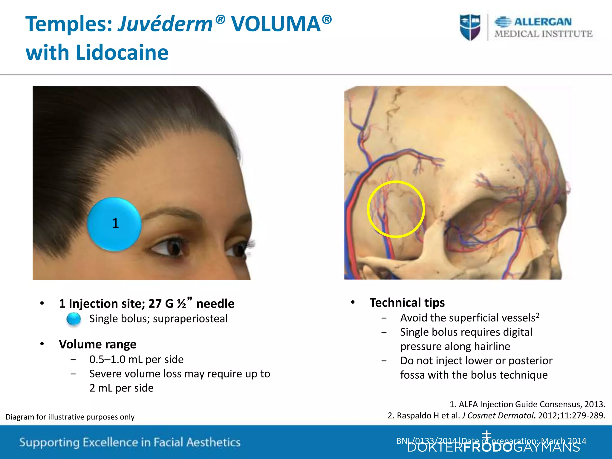 Training for periorbital and upper face treatment with botox and ...