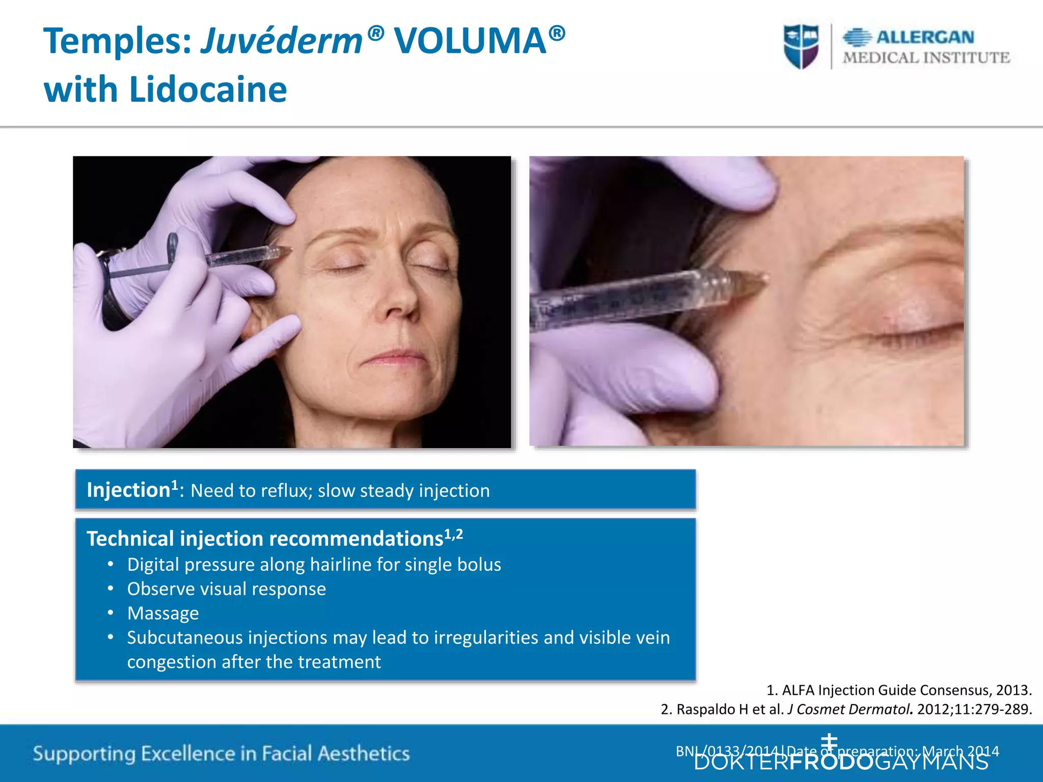 Training for periorbital and upper face treatment with botox and Juvederm | PPTX